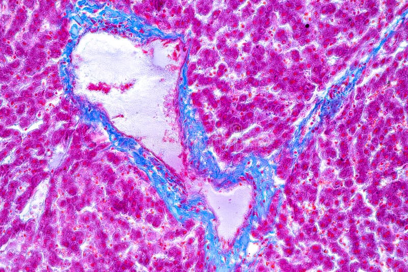 Tissue of Liver Under the Microscope for Education. Stock Image - Image ...