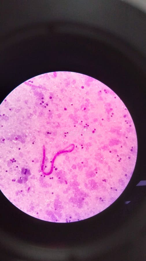 Tissue Nematodes :Asian Bloodworm Stock Image - Image of bloodwor ...