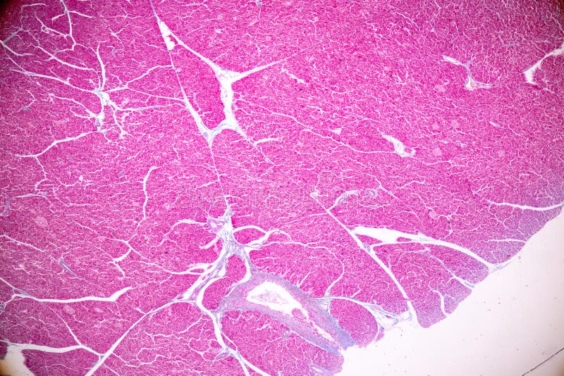 Tissue of Pancreas is an Organ of the Digestive System and Endocrine ...