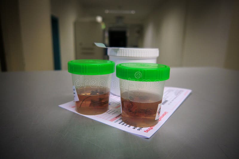 Tissue Samples Are Placed In Formalin For Subsequent Examination By A
