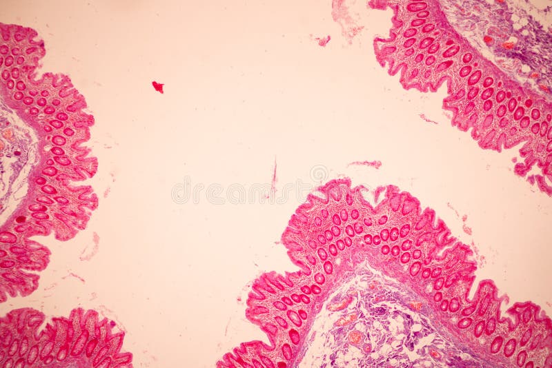 Tissue of Small Intestine Duodenum, Large Intestine Human and Stomach ...