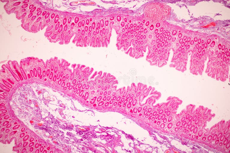Tissue of Small Intestine Duodenum, Large Intestine Human and Stomach ...