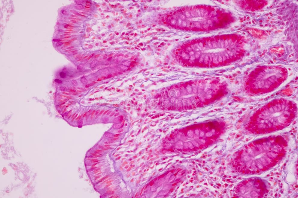 Tissue of Small Intestine Duodenum, Large Intestine Human and Stomach ...