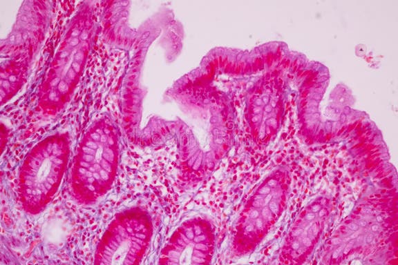 Tissue of Small Intestine Duodenum, Large Intestine Human and Stomach ...