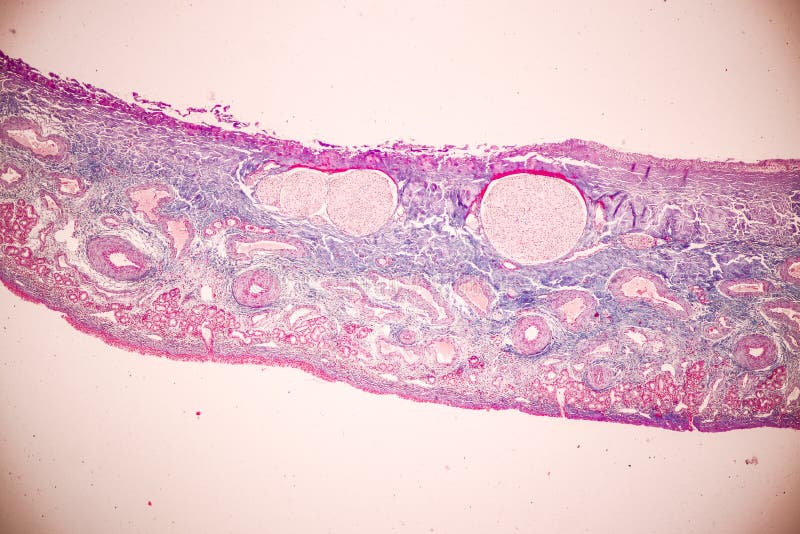 Tissue of Small Intestine (Duodenum), Large Intestine Human and Stomach ...