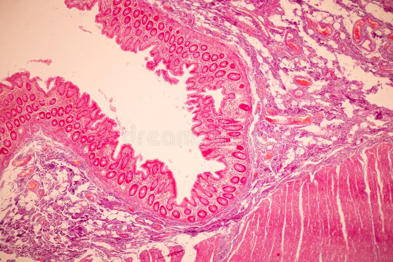 Tissue of Small Intestine Duodenum, Large Intestine Human and Stomach ...