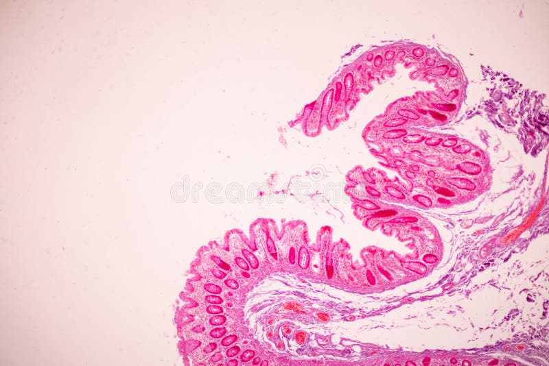 Tissue of Small Intestine Duodenum, Large Intestine Human and Stomach ...