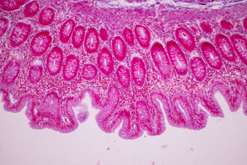Tissue of Small Intestine Duodenum, Large Intestine Human and Stomach ...
