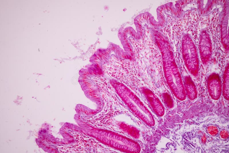 Tissue of Small Intestine Duodenum, Large Intestine Human and Stomach ...