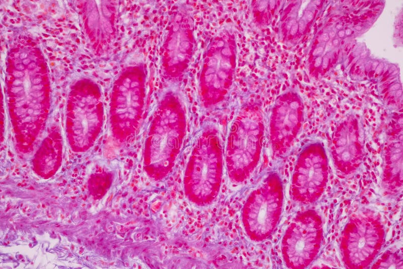 254 Large Intestine Histology Stock Photos - Free & Royalty-Free Stock ...