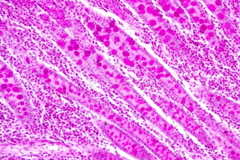 Small Intestine Duodenum and Vermiform Appendix Human Under the ...