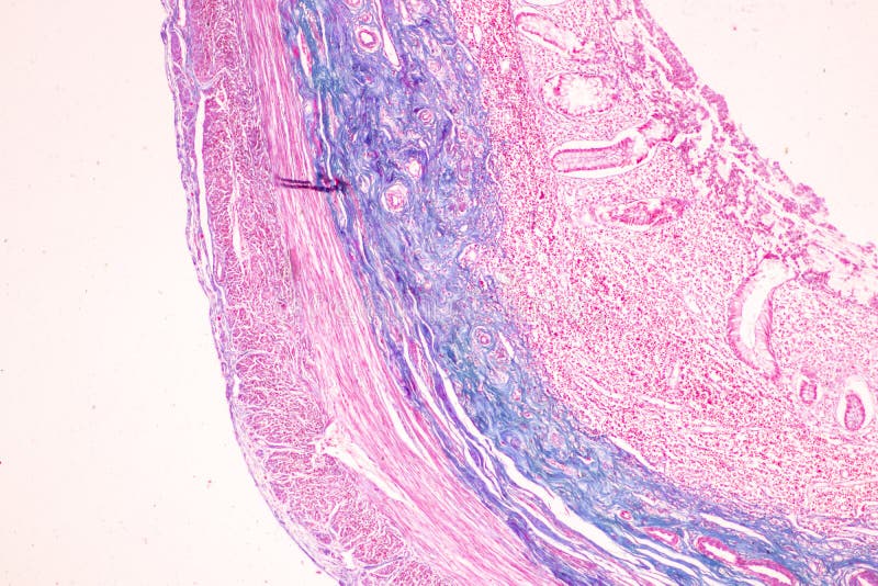 Small Intestine Duodenum and Vermiform Appendix Human Under the ...