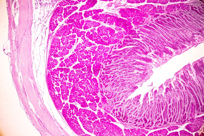 Small Intestine Duodenum and Vermiform Appendix Human Under the ...
