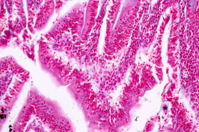 Tissue of Small Intestine or Small Bowel Under the Microscopic. Stock ...