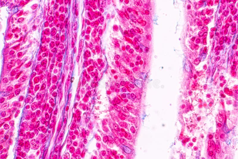 Tissue Of Small Intestine Or Small Bowel Under The Microscopic. Stock ...