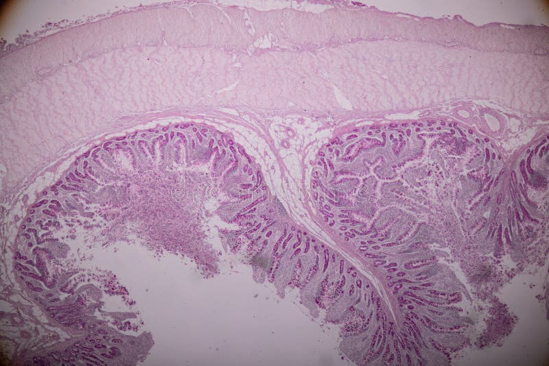 Tissue of Small Intestine or Small Bowel Under the Microscopic. Stock ...
