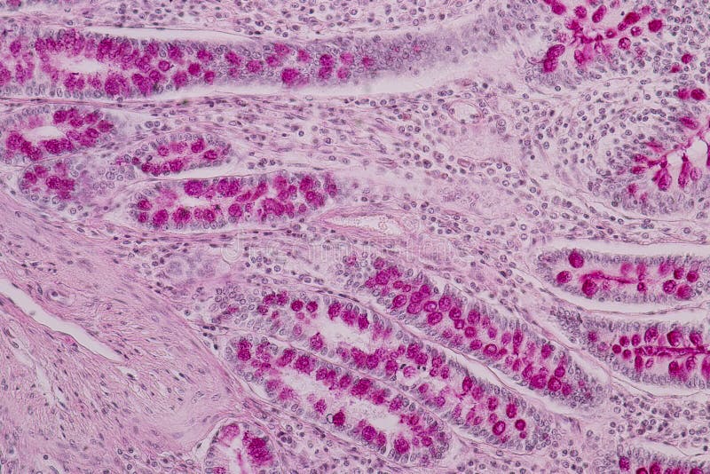 Tissue of Small Intestine or Small Bowel Under the Microscopic. Stock ...