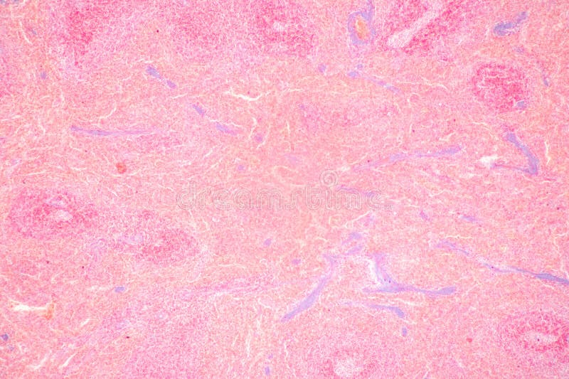 Tissue of Spleen Human, Liver Human and Kidney Human Under the ...