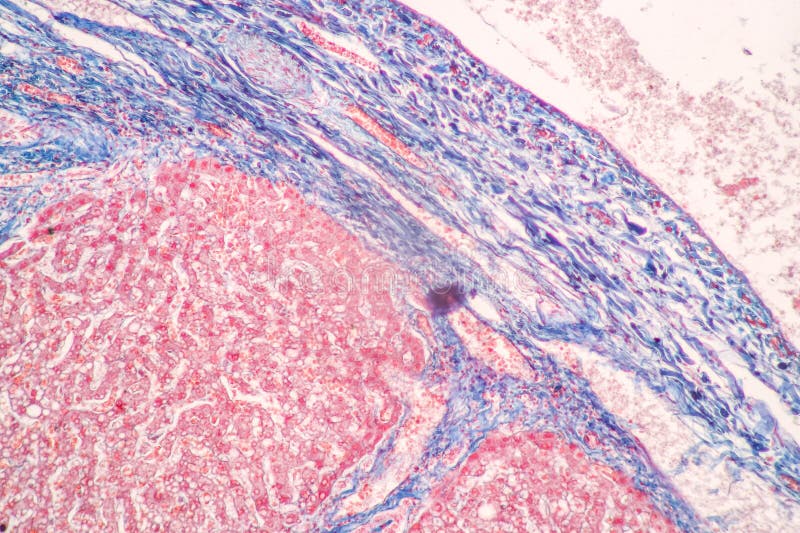 Tissue of Spleen Human, Liver Human and Kidney Human Under the ...