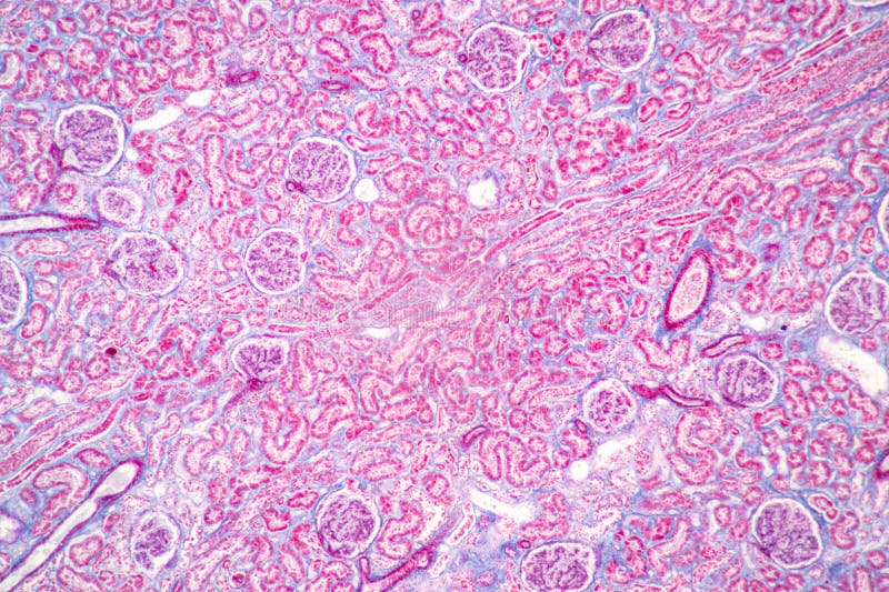 Tissue of Spleen Human, Liver Human and Kidney Human Under the ...
