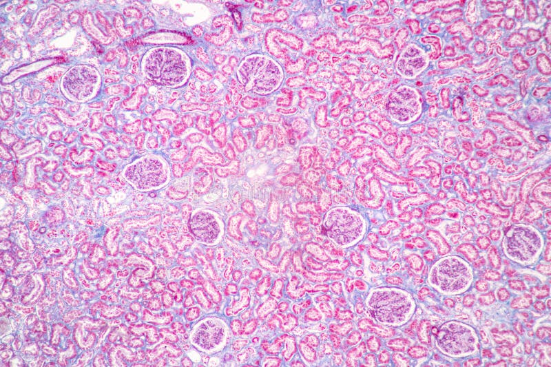 Tissue of Spleen Human, Liver Human and Kidney Human Under the ...