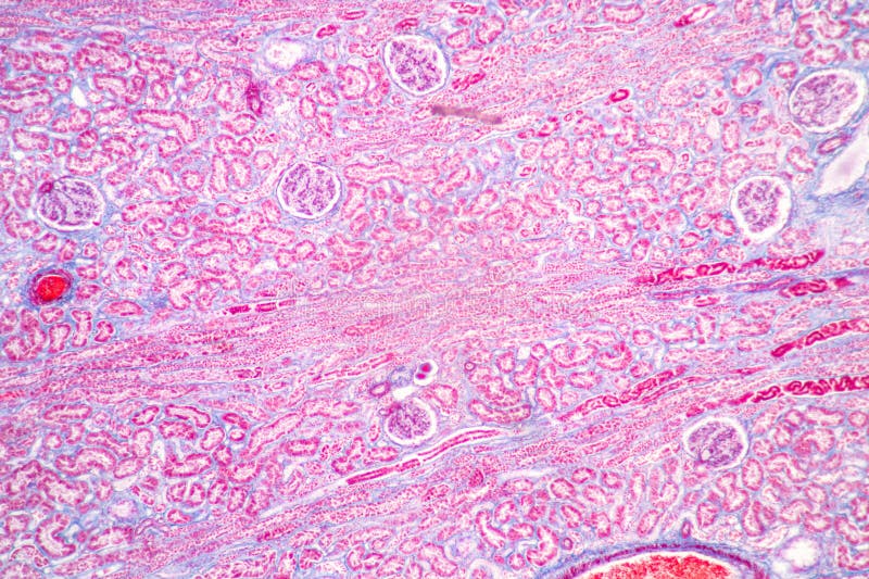 Tissue of Spleen Human, Liver Human and Kidney Human Under the ...