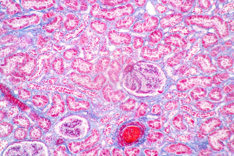 Tissue of Spleen Human, Liver Human and Kidney Human Under the ...