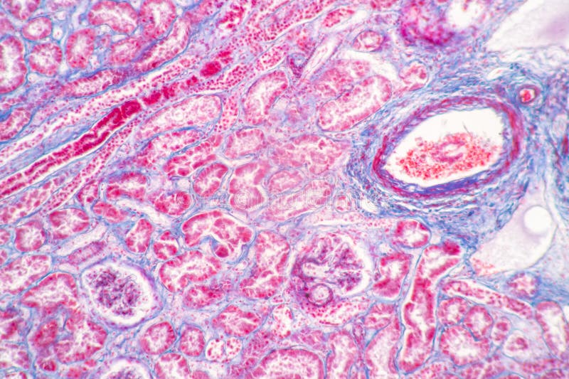 Tissue of Spleen Human, Liver Human and Kidney Human Under the ...