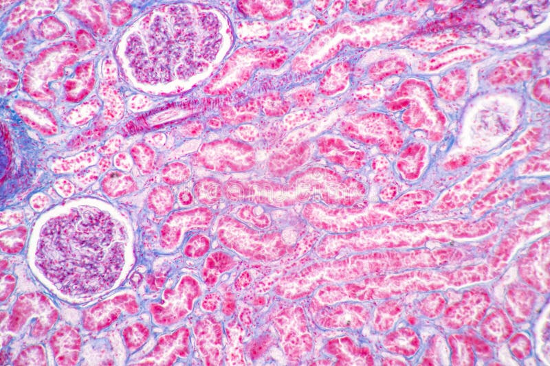 Tissue of Spleen Human, Liver Human and Kidney Human Under the ...