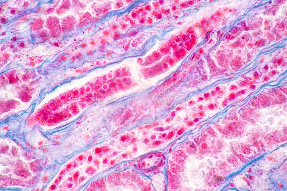 Tissue of Spleen Human, Liver Human and Kidney Human Under the ...