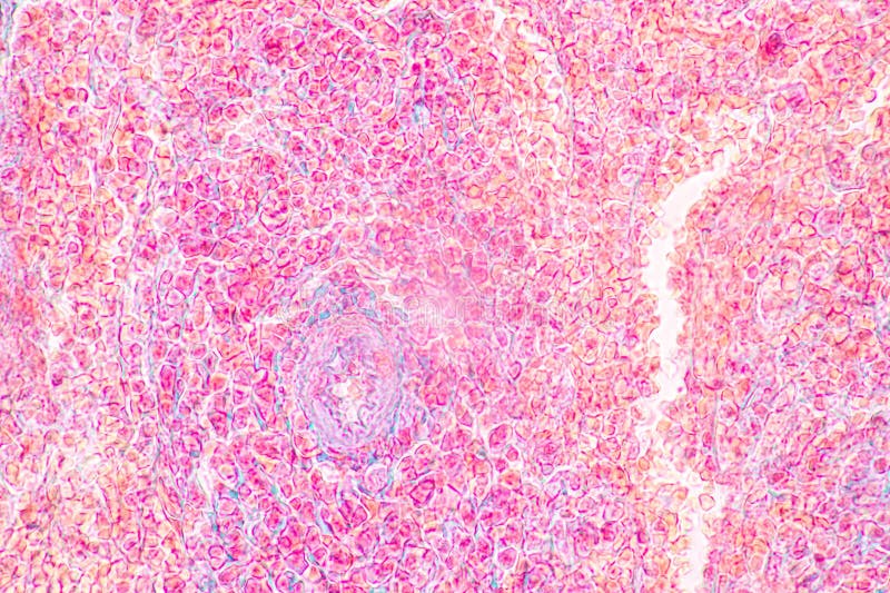 Tissue of Spleen Human, Liver Human and Kidney Human Under the ...