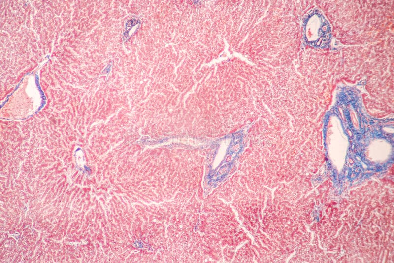 Tissue of Spleen Human, Liver Human and Kidney Human Under the ...