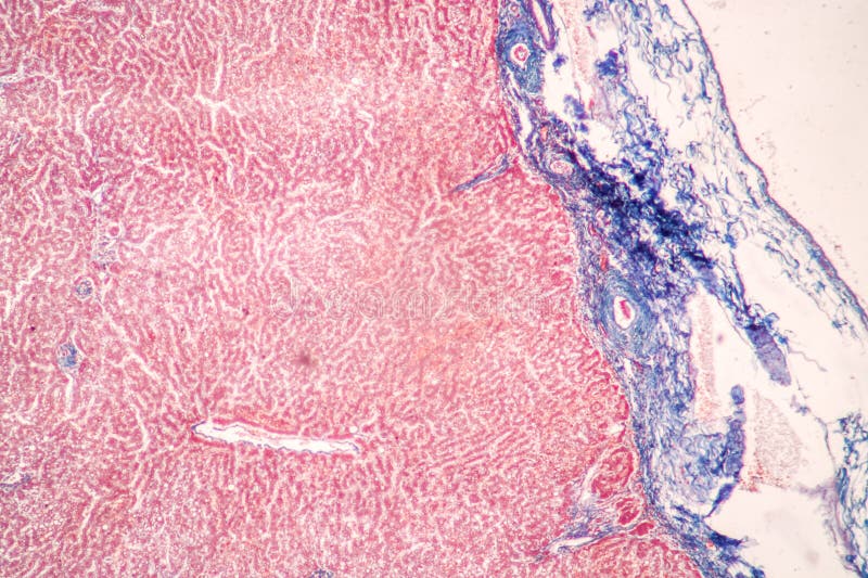 Tissue of Spleen Human, Liver Human and Kidney Human Under the ...