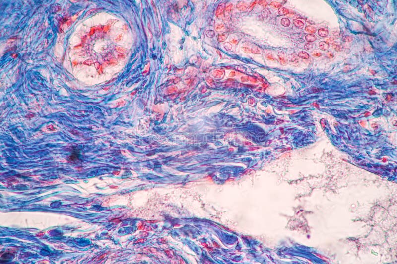 Tissue of Spleen Human, Liver Human and Kidney Human Under the ...