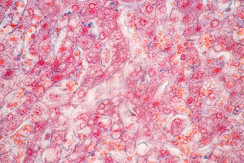Tissue of Spleen Human, Liver Human and Kidney Human Under the ...