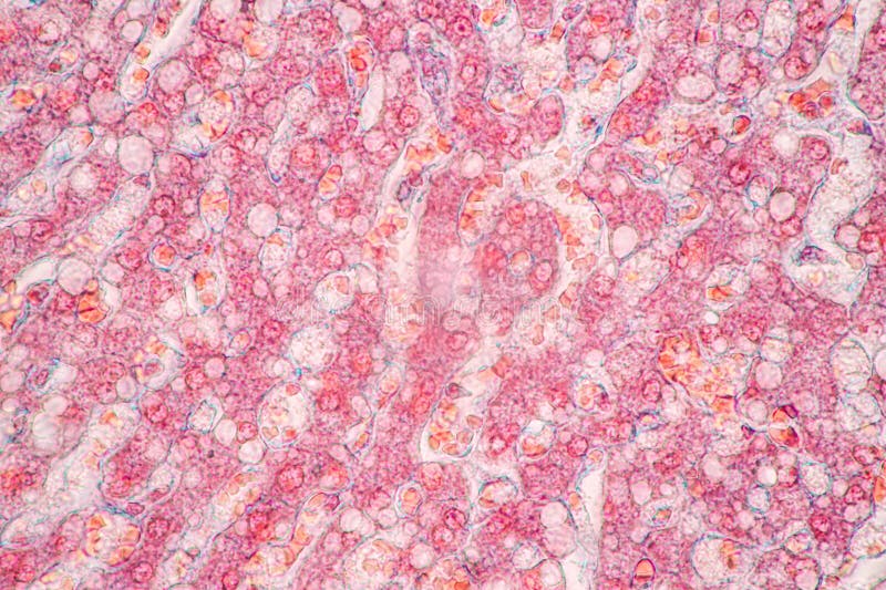 Tissue of Spleen Human, Liver Human and Kidney Human Under the ...