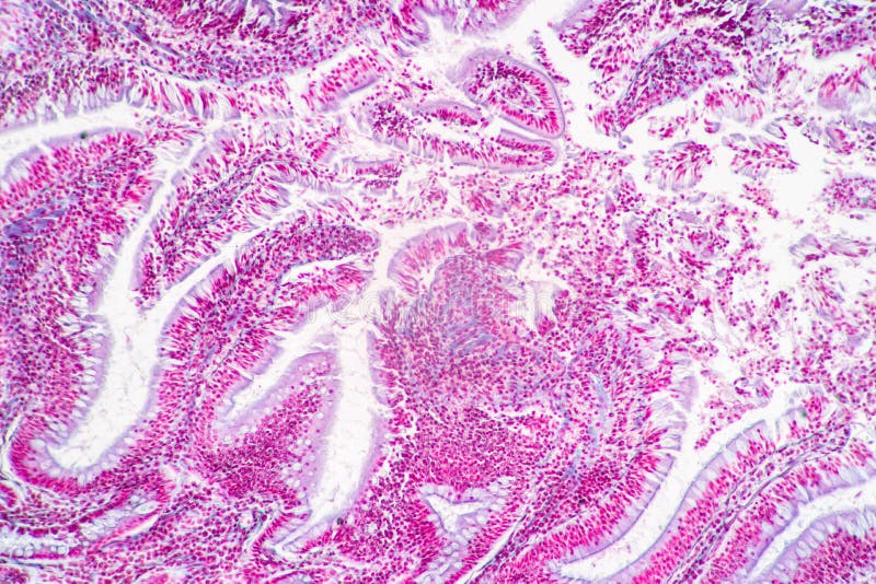 Tissue of Stomach Human, Small Intestine Human, Pancreas Human and ...