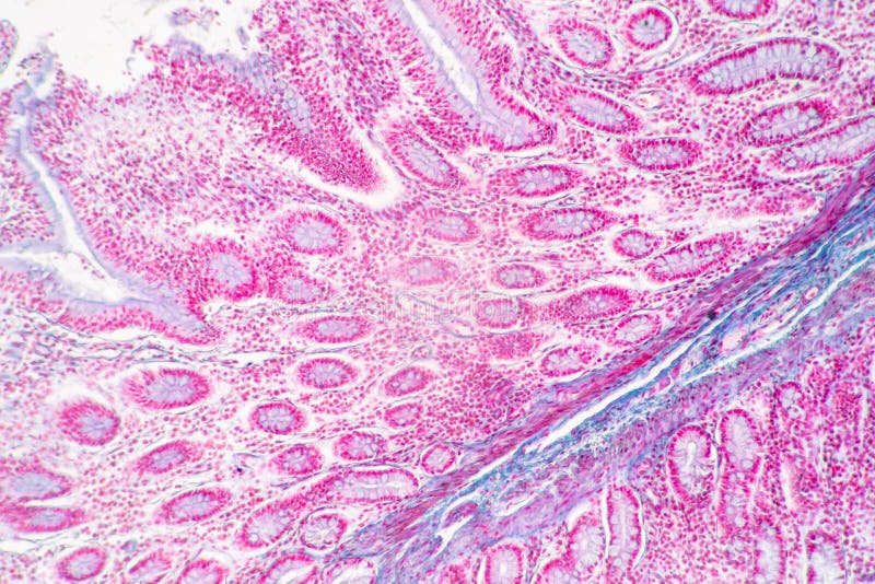Tissue of Stomach Human, Small Intestine Human, Pancreas Human and ...