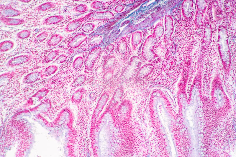 Tissue of Stomach Human, Small Intestine Human, Pancreas Human and ...