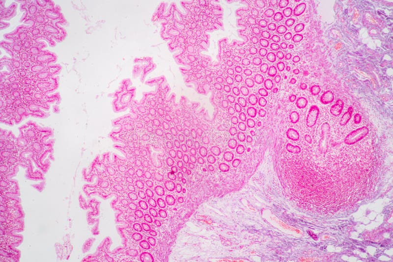 Tissue of Stomach Human, Small Intestine Human, Pancreas Human and ...
