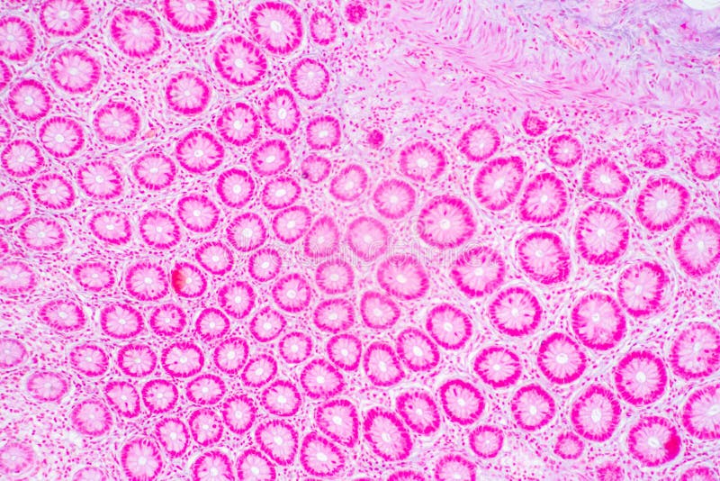 Tissue of Stomach Human, Small Intestine Human, Pancreas Human and ...