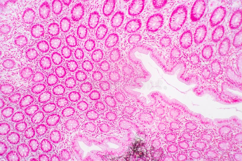 Tissue of Stomach Human, Small Intestine Human, Pancreas Human and ...