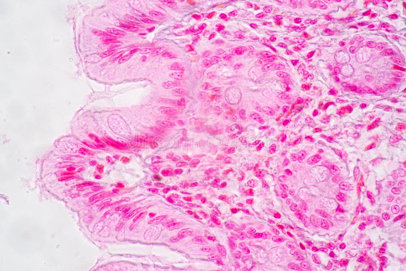 Tissue of Stomach Human, Small Intestine Human, Pancreas Human and ...