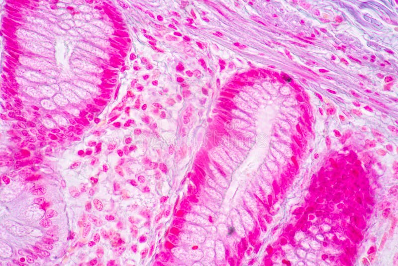 Tissue of Stomach Human, Small Intestine Human, Pancreas Human and ...