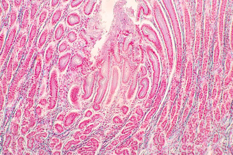 Tissue of Stomach Human, Small Intestine Human, Pancreas Human and ...