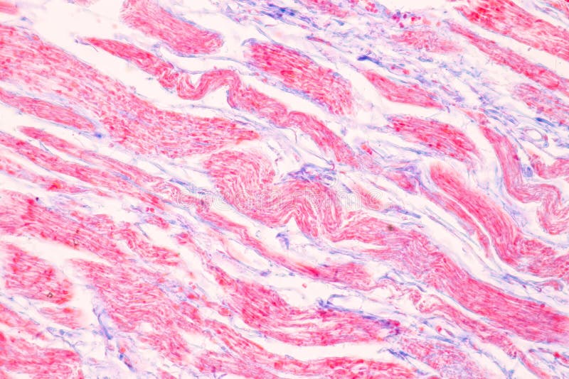 Tissue of Stomach Human Under the Microscope in Lab. Stock Image ...