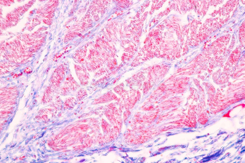 Tissue of Stomach Human Under the Microscope in Lab. Stock Image ...