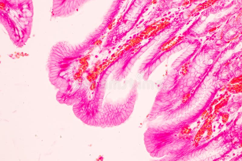 Tissue of Stomach Human Under the Microscope in Lab. Stock Photo ...