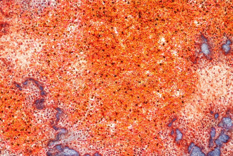 Tissus Gras De Coeur Sous Le Microscope Image stock - Image of glace ...
