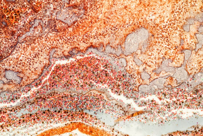 Tissus gras de coeur image stock. Image du fibrillation - 196728671